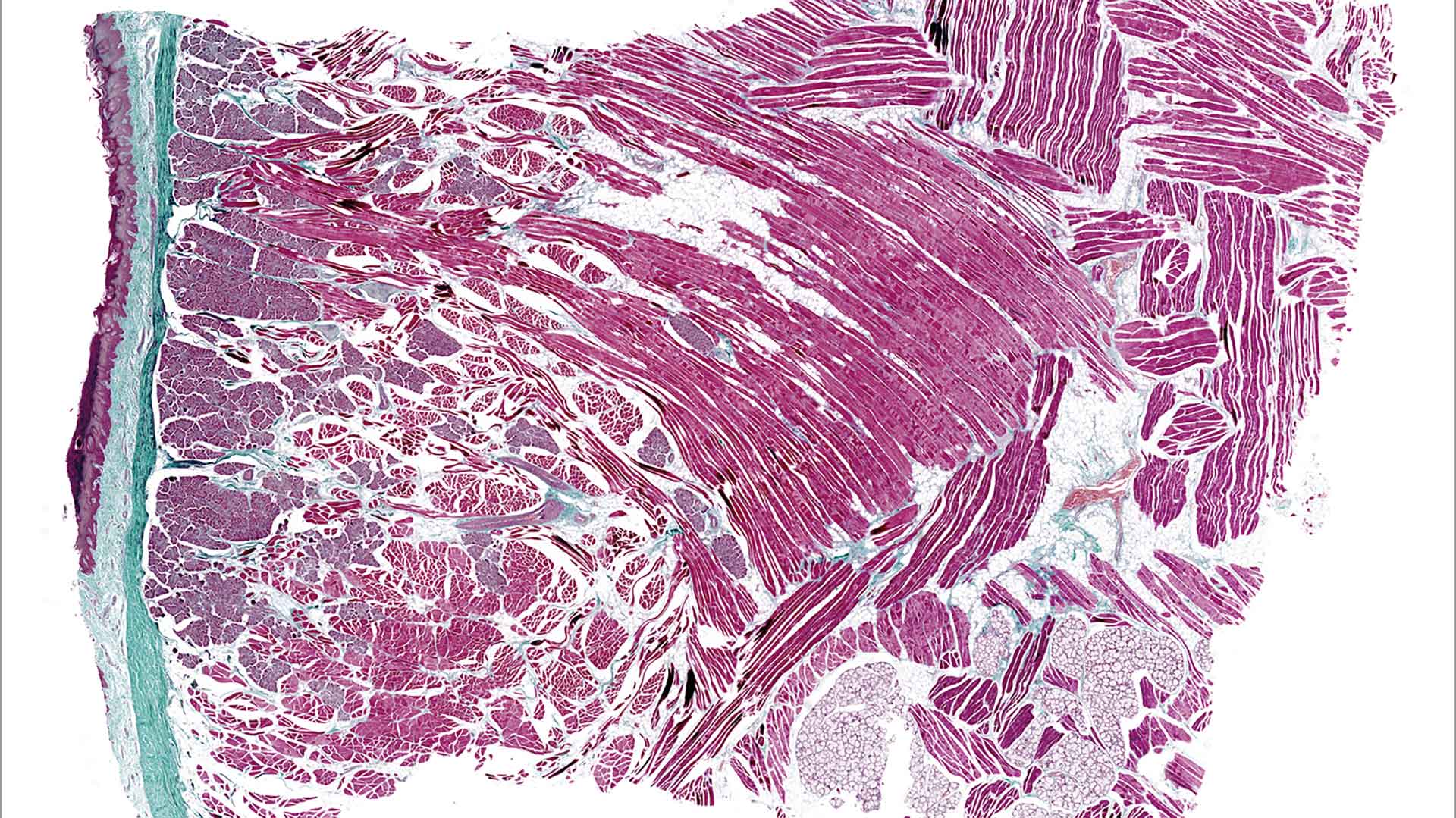 Imaging Large Brain And Tissue Sections Whole Slide Imaging