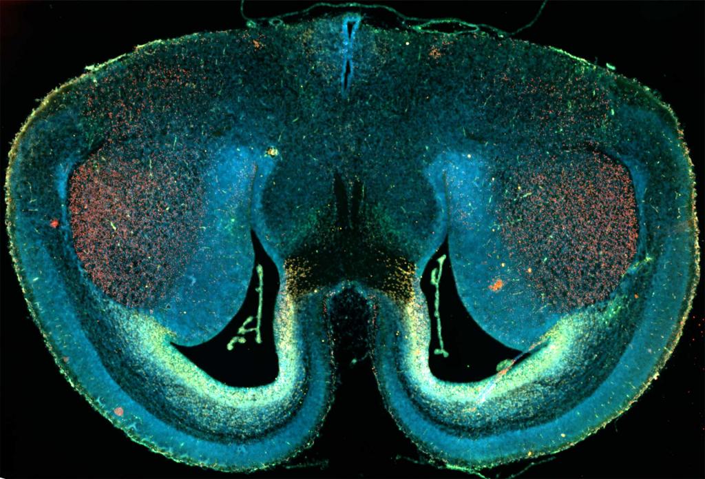 Imaging Large Brain And Tissue Sections Whole Slide Imaging