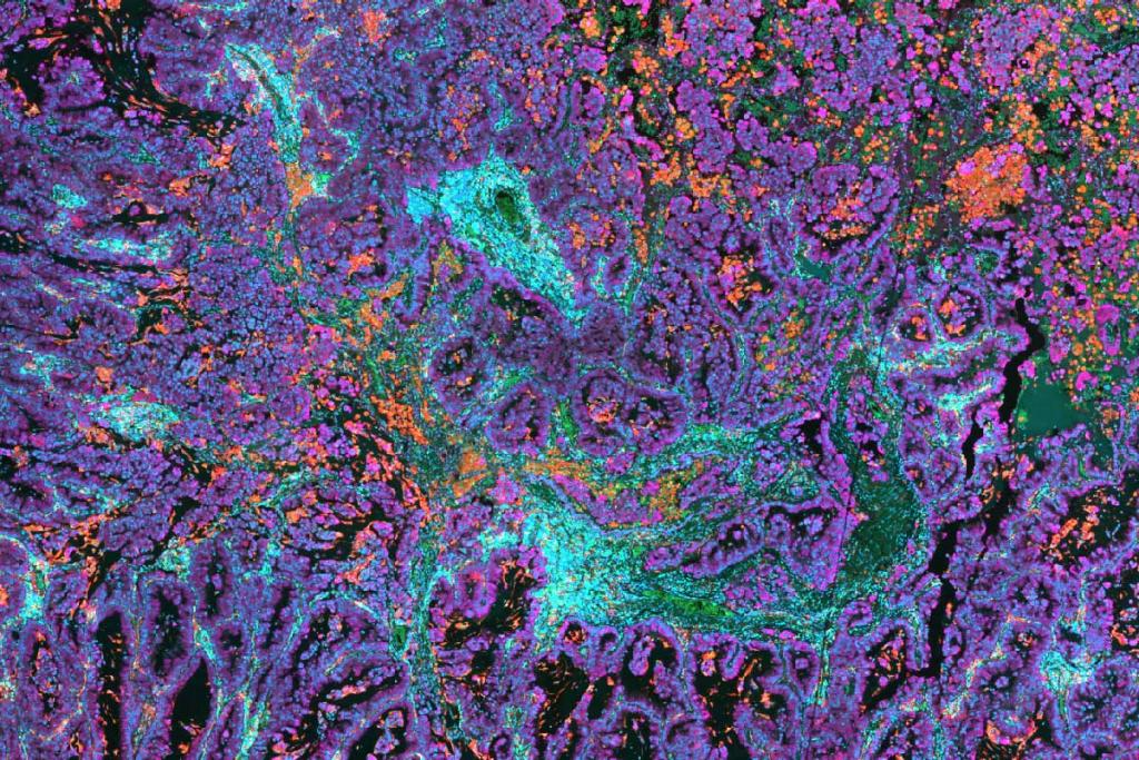 Imaging Large Brain And Tissue Sections Whole Slide Imaging