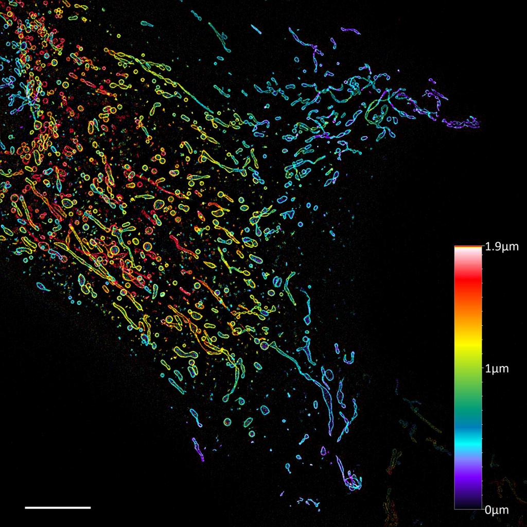 Live Cell Imaging With Zeiss Microscope Systems