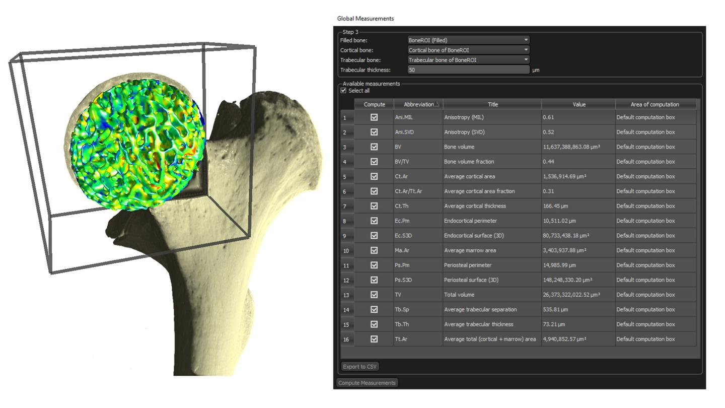 Multiscale bone acquisitions with X-ray imaging