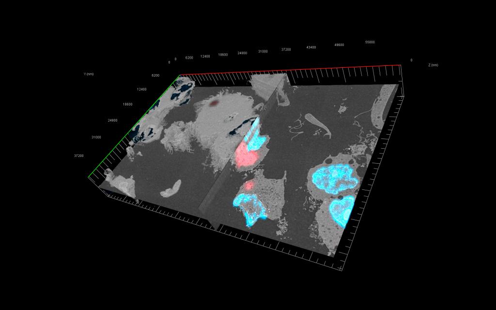 Array Tomography | Exemples d'application