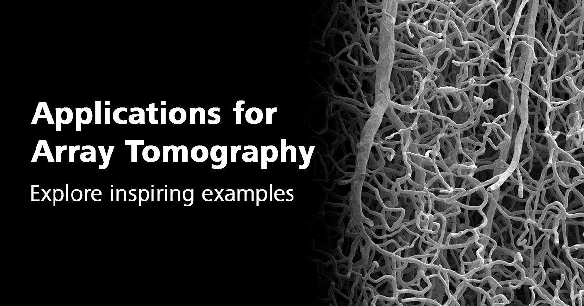 Array Tomography | Ejemplos de aplicación