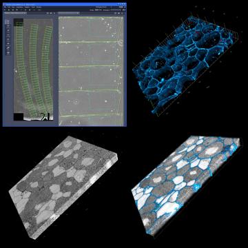 Volume EM with Array Tomography