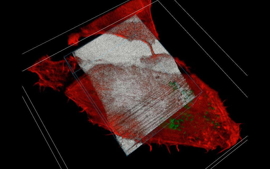 Cryo FIB-SEM | Application Examples
