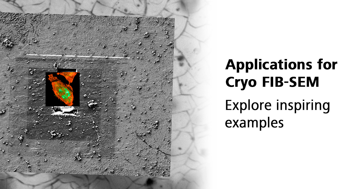 Cryo FIB-SEM | Application Examples