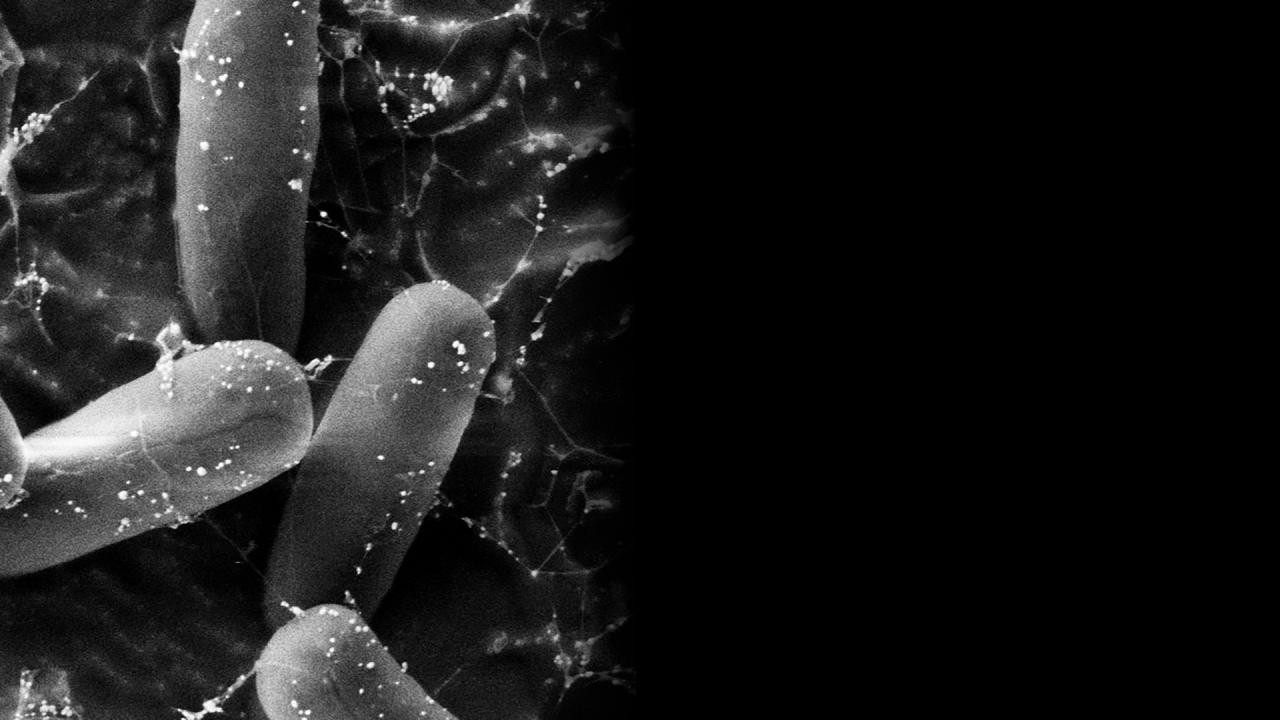 Cryo FIB-SEM | Application Examples