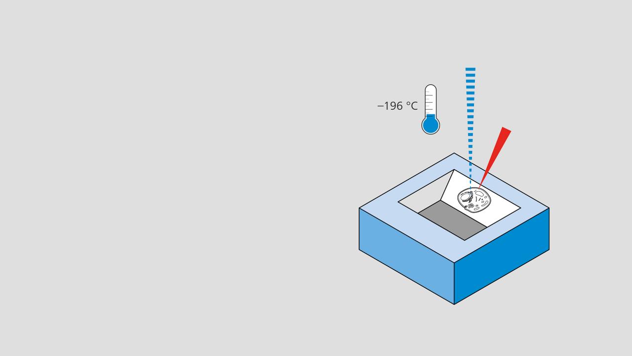 Volume EM with Cryogenic FIB-SEM