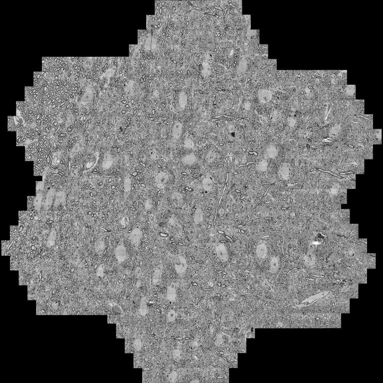 Volume Em With Multibeam Array Tomography
