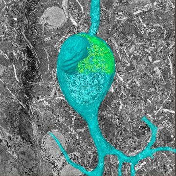 Serial Block-Face SEM | Application Examples