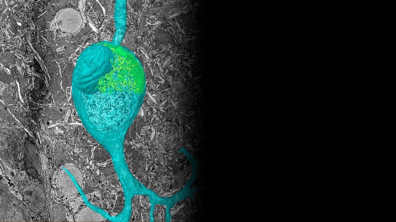 Serial Block-Face SEM | Application Examples