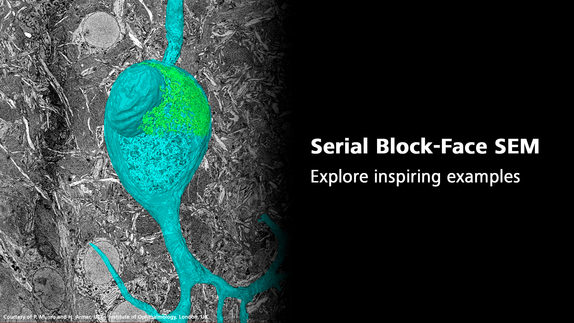 Serial Block-Face SEM | Application Examples
