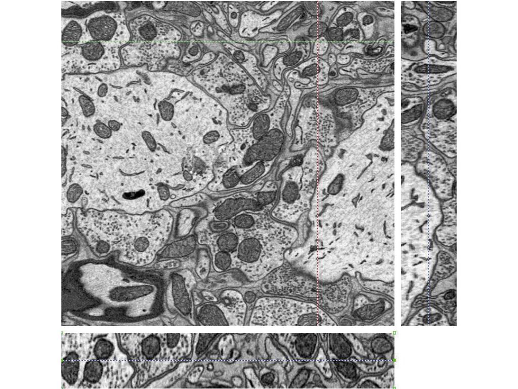 Serial Block-Face SEM | Application Examples