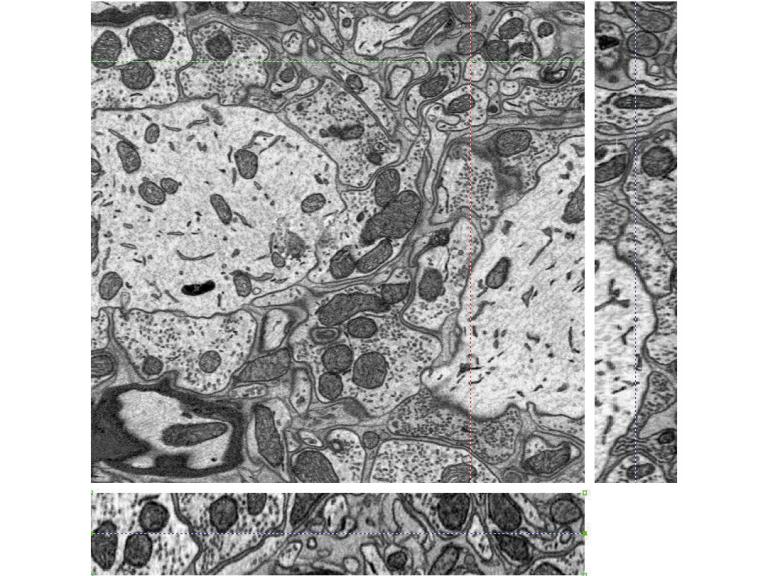Serial-Blockface-SEM | Anwendungsbeispiele