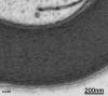 Volume EM with Serial Block-Face Scanning Electron Microscopy