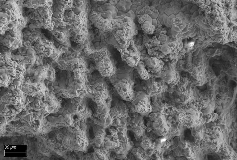 Microscopy Solutions for aluminum alloys