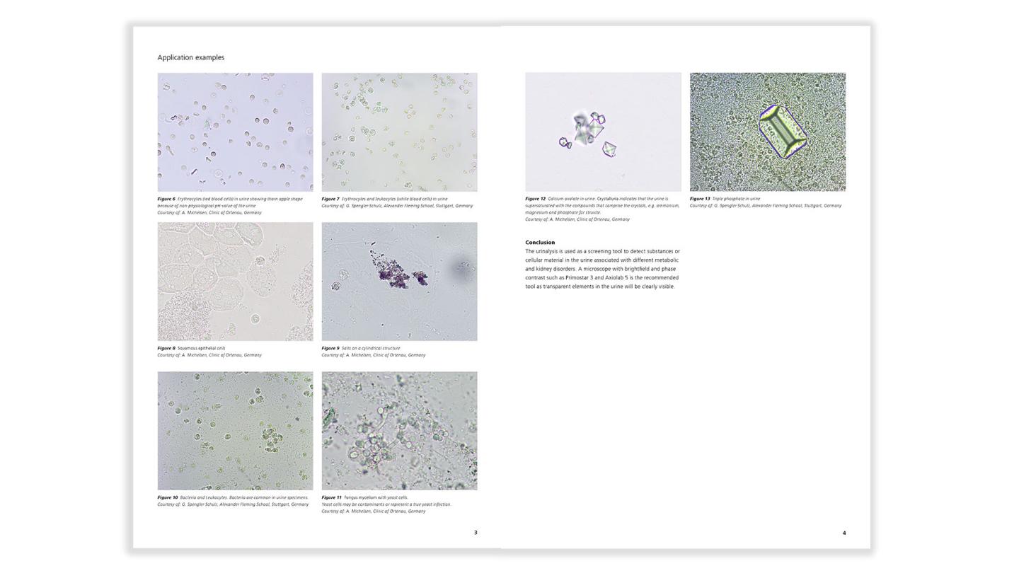 Light Microscopic Analysis of Urine | Application Note