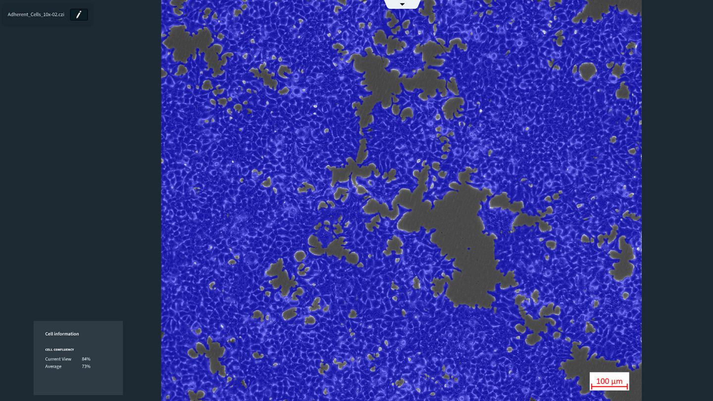 ZEISS Labscope - AI Cell Confluency & AI Cell Counting