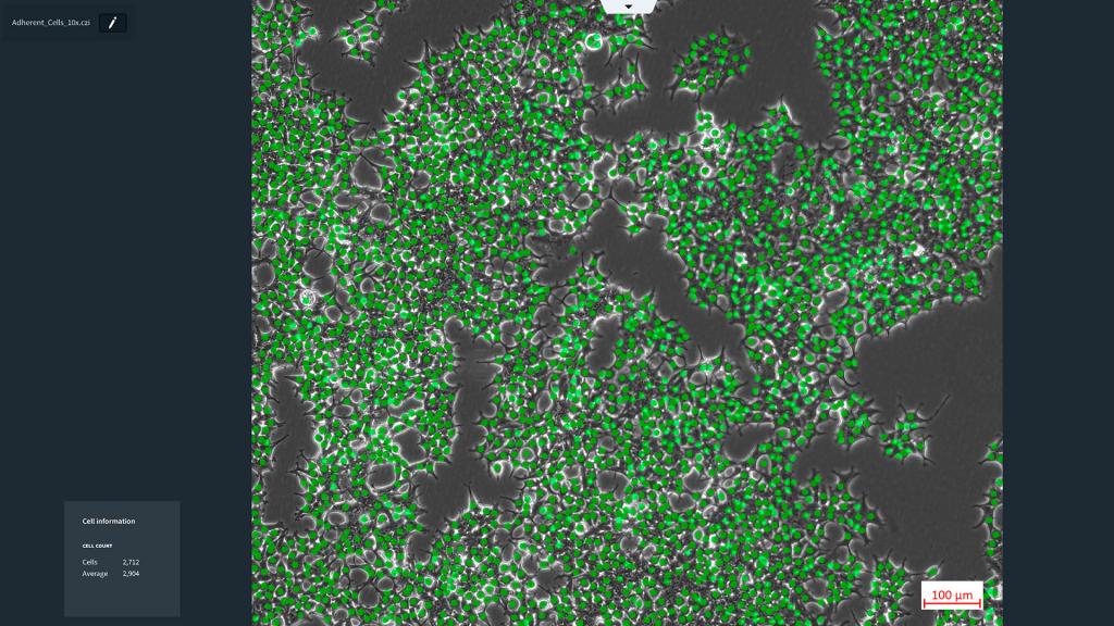 ZEISS Labscope - AI Cell Confluency & AI Cell Counting