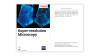 Superresolution Microscopy | Ebook