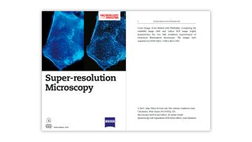 Superresolution Microscopy | Ebook