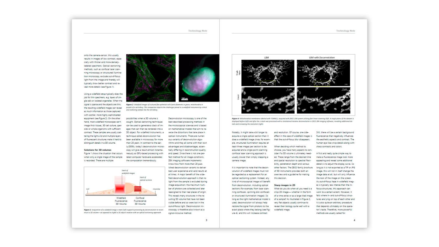 How to Get Better Fluorescence Images with Your Widefield Microscope ...