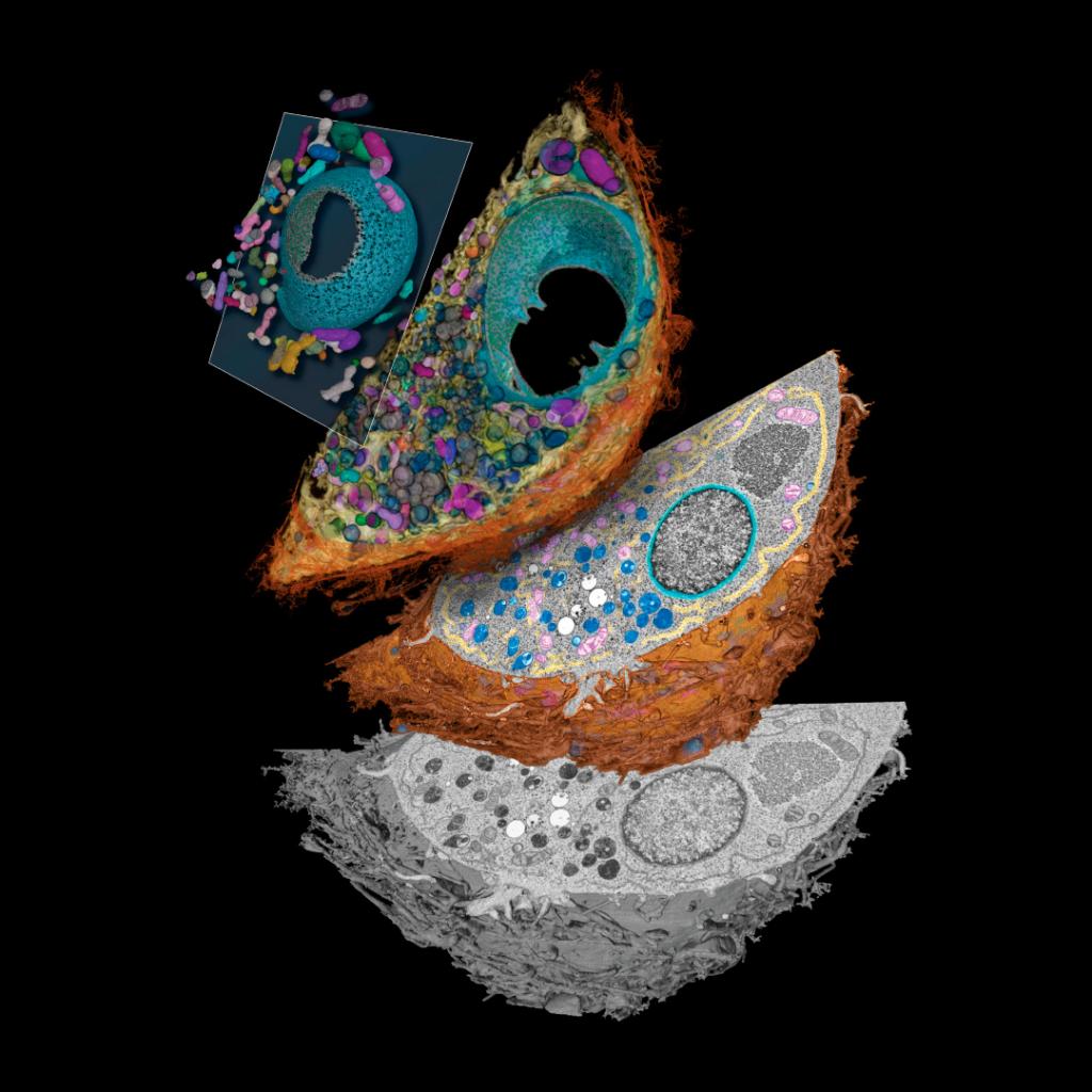 Volume EM Techniques for Life Science Research