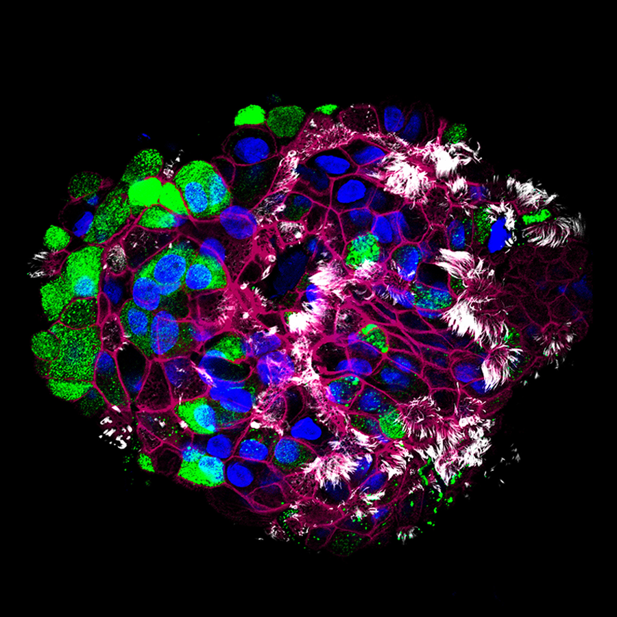 3D tissue models webinar series | ZEISS