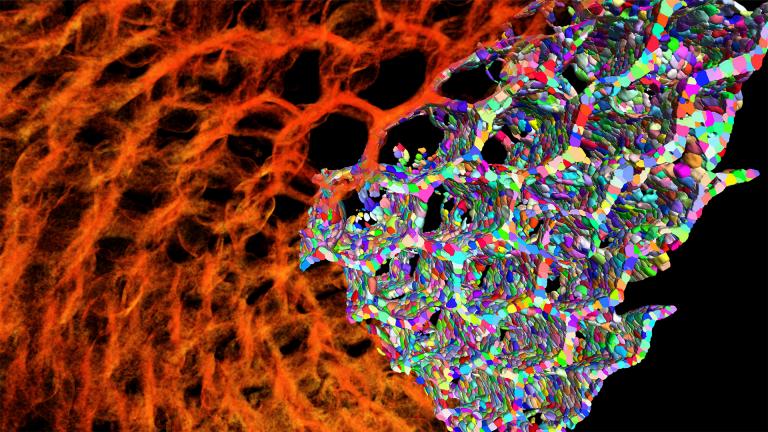 Webinar: 3D X-Ray Microscopy: High-End Capabilities, Now Within Reach