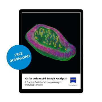 AI in Microscopy: Deep Learning for Image Analysis | ZEISS