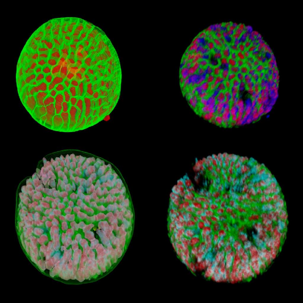 Image Analysis Made Simple with ZEISS arivis