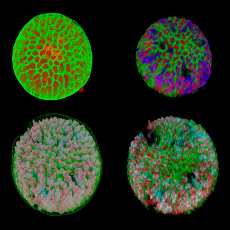 Image Analysis Made Simple with ZEISS arivis
