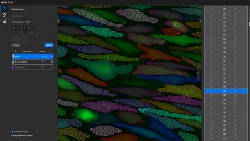 Image Analysis Made Simple with ZEISS arivis