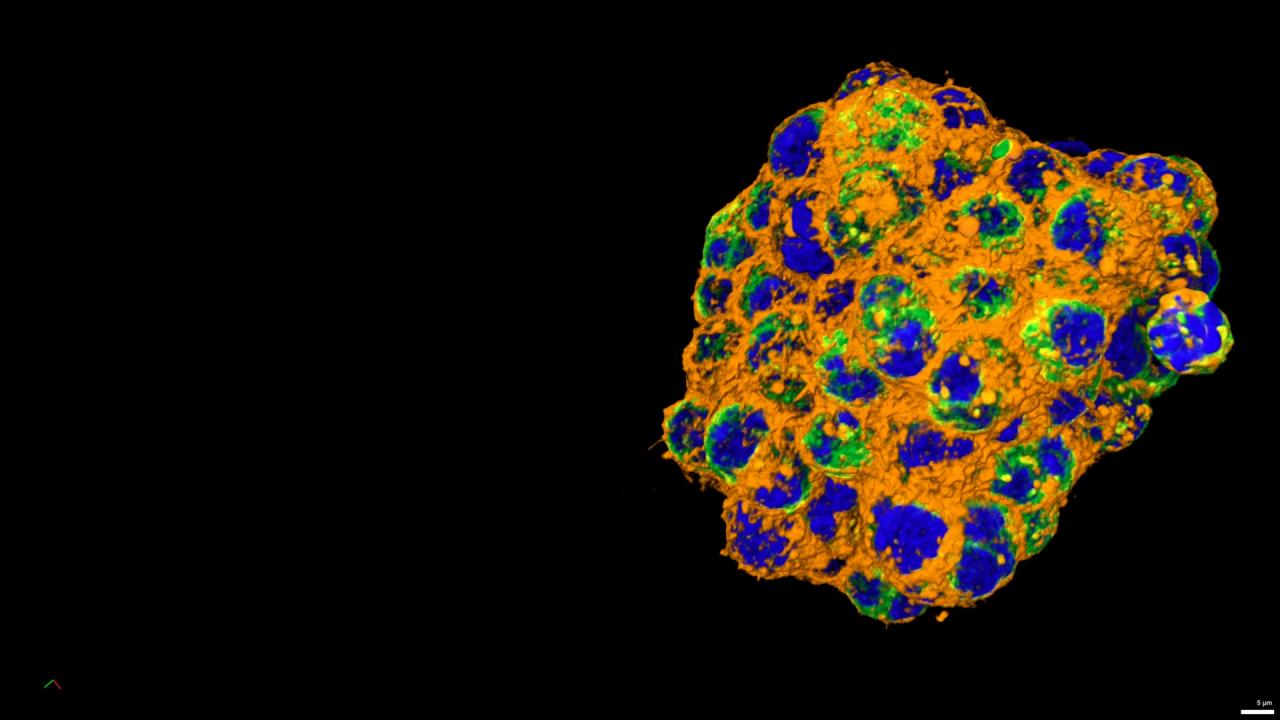 Image Analysis Made Simple with ZEISS arivis