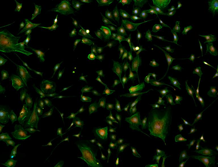 ZEISS Axiocam 203 mono - Your 3 MP microscope fluorescence camera