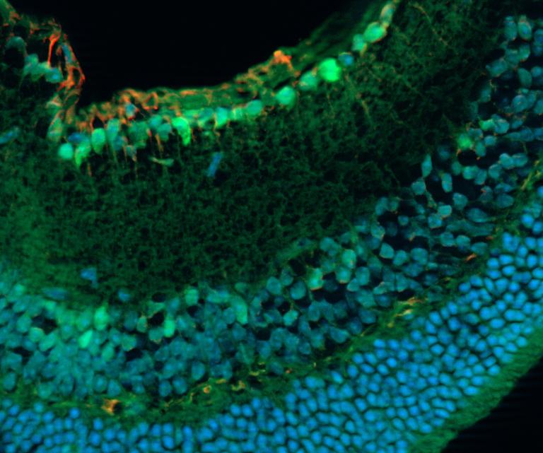 ZEISS Axiocam 705 mono: High Resolution Imaging at High Speed