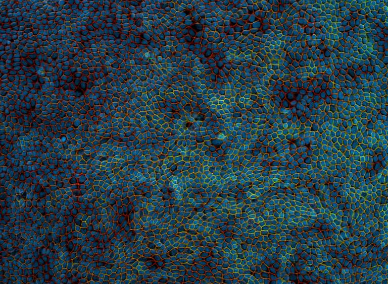 ZEISS Axiocam 712 mono: Fast High Resolution Imaging of Large Areas