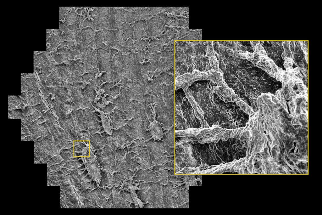 ZEISS MultiSEM: The World’s Fastest Scanning Electron Microscope