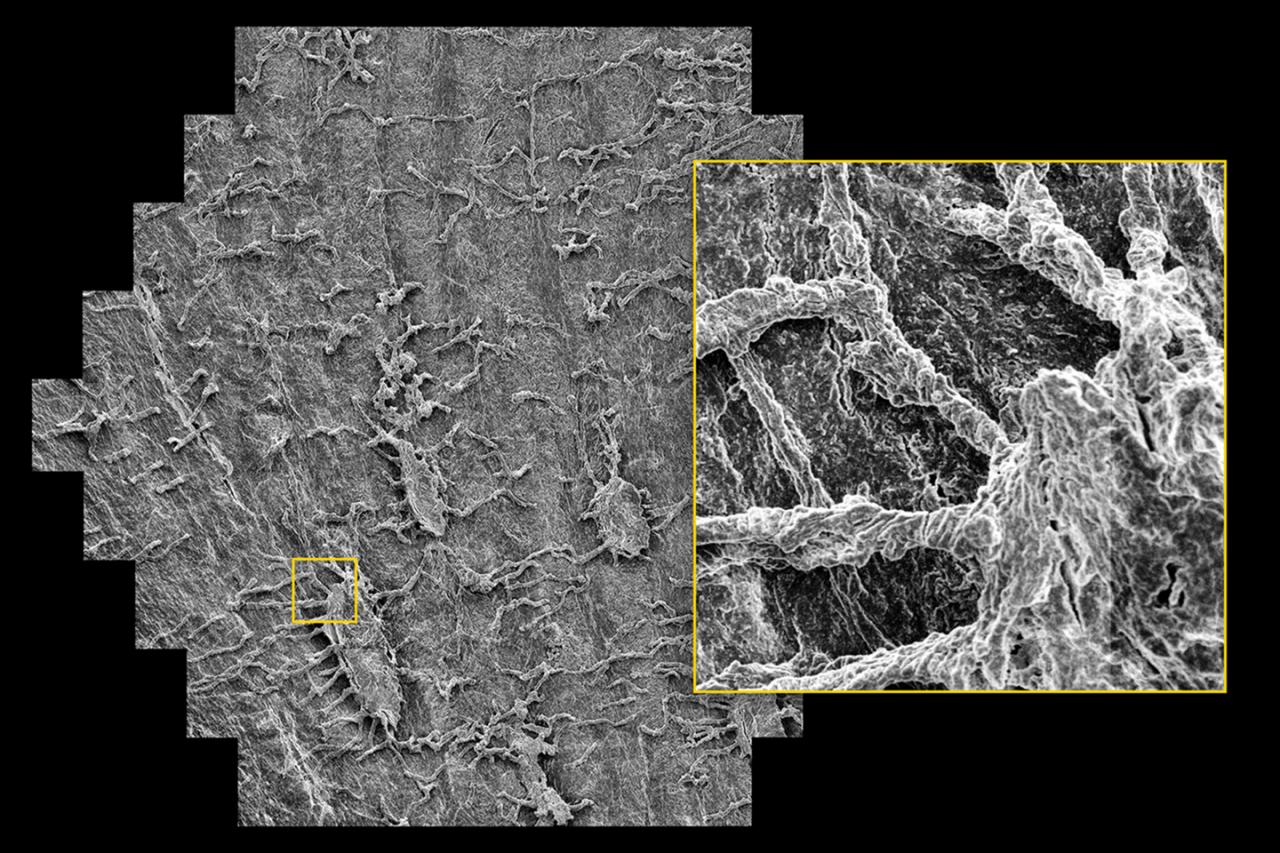ZEISS MultiSEM: The World’s Fastest Scanning Electron Microscope