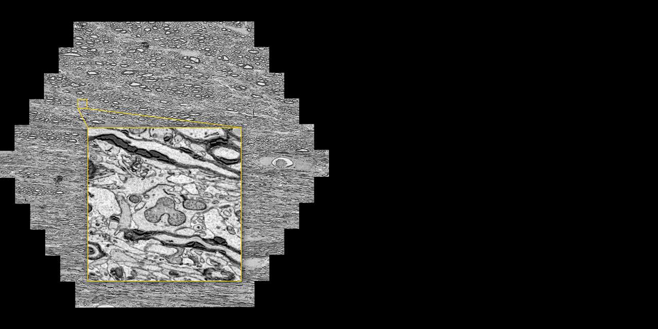 ZEISS MultiSEM: The World’s Fastest Scanning Electron Microscope