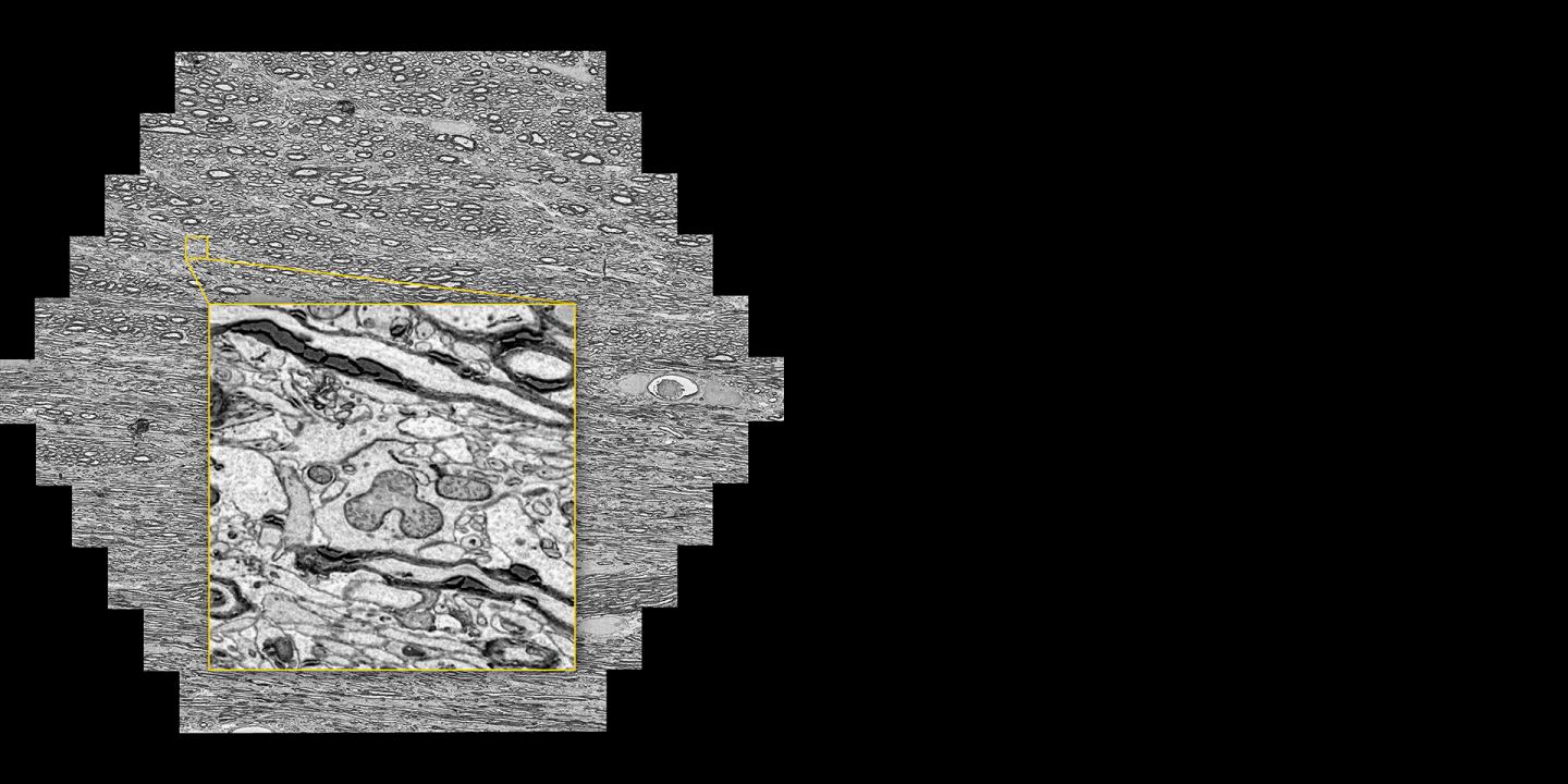 ZEISS MultiSEM: The World’s Fastest Scanning Electron Microscope
