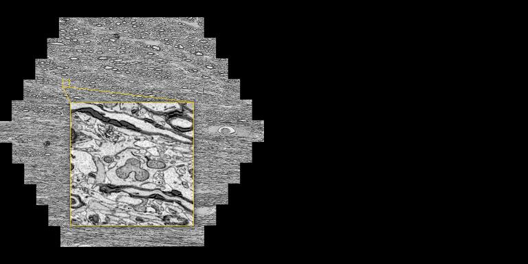 ZEISS MultiSEM: The World’s Fastest Scanning Electron Microscope