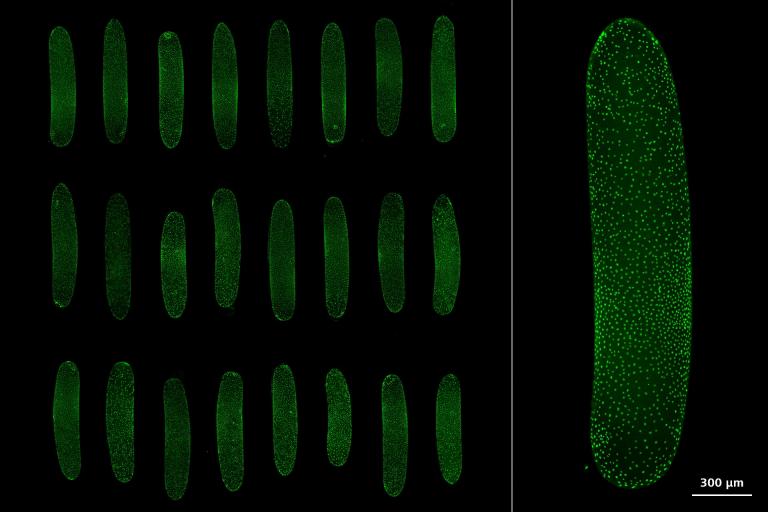 ZEISS Celldiscoverer 7 – High-Quality Data Acquisition Made Easy
