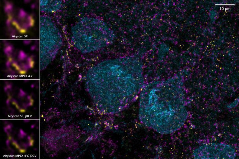 ZEISS Airyscan | Super-resolution imaging and molecular measurements