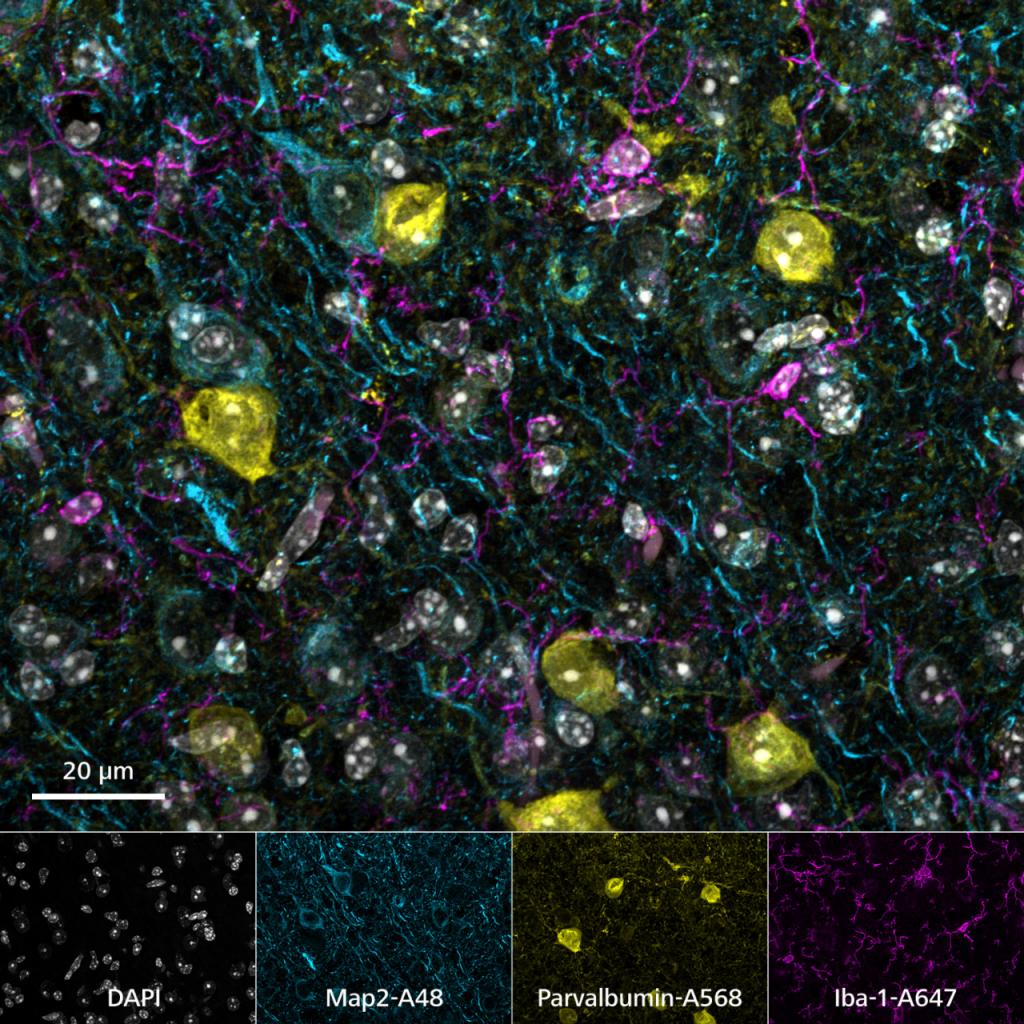 ZEISS LSM 910 | Advanced confocal imaging for your research