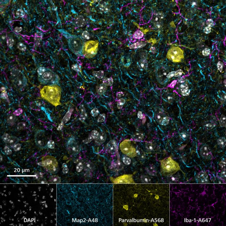 ZEISS LSM 910 | Advanced confocal imaging for your research