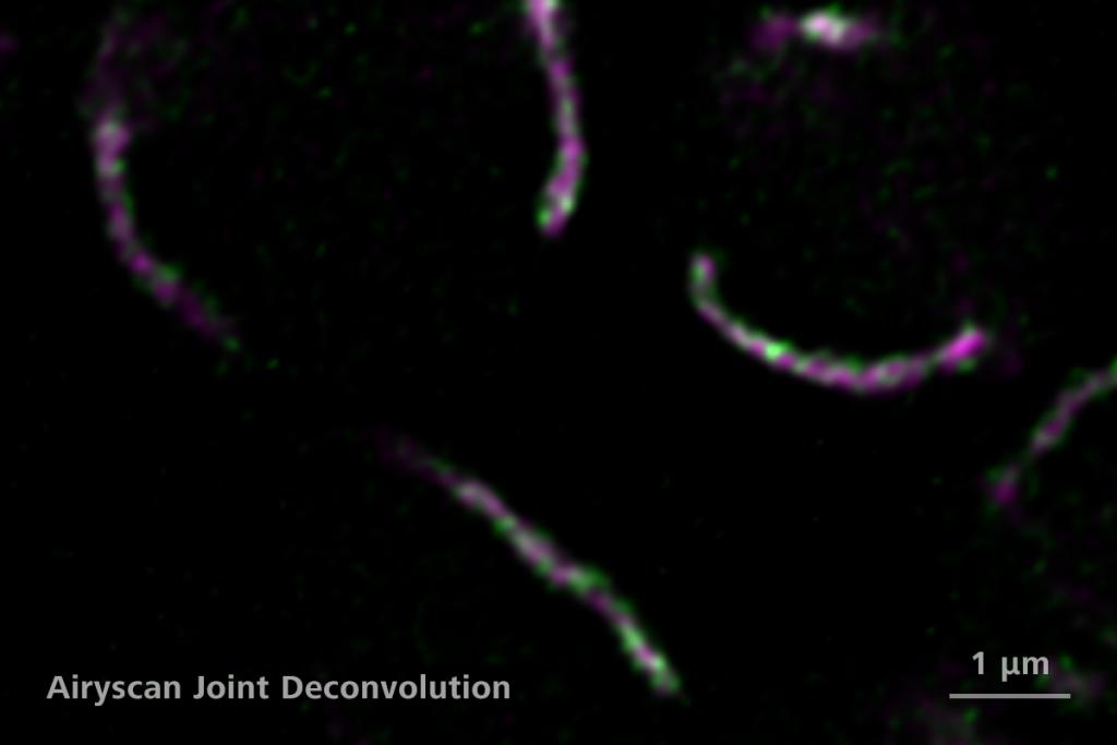 ZEISS Airyscan | Super-resolution imaging and molecular measurements