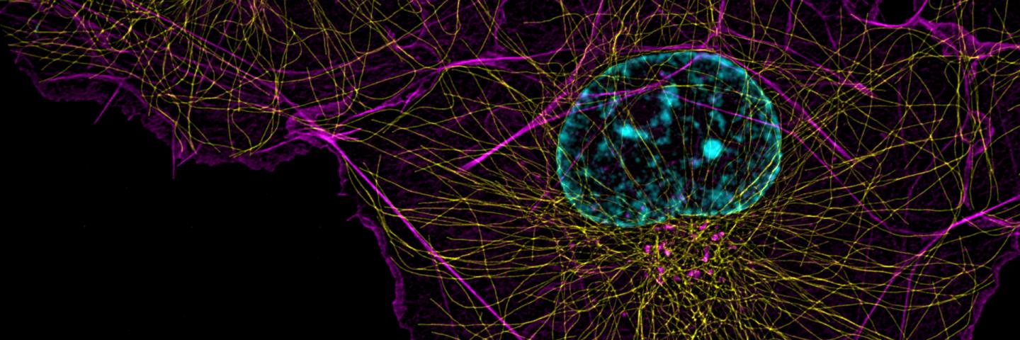 ZEISS Super-Resolution Microscopes