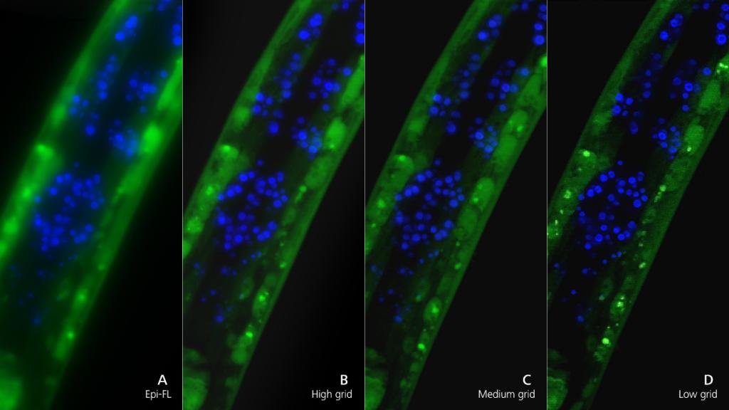 ZEISS Apotome 3: Optical sectioning in fluorescence imaging for ...