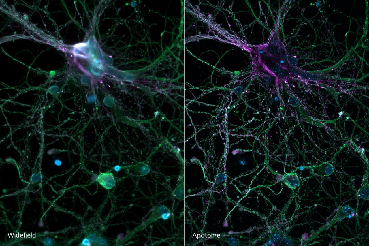 ZEISS Apotome 3: Optical sectioning in widefield fluorescence microscopy